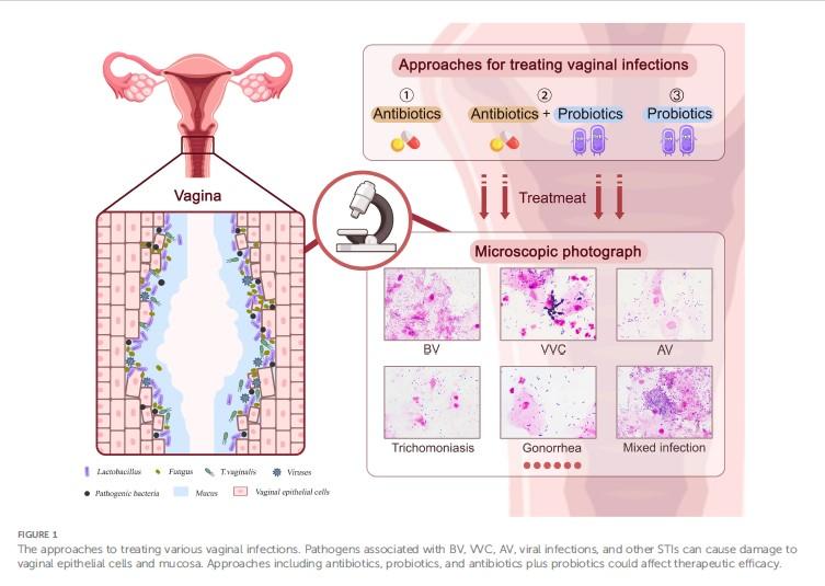 FloraCap Feminine Probiotic | BoriCap – Heale Doctor Formulated