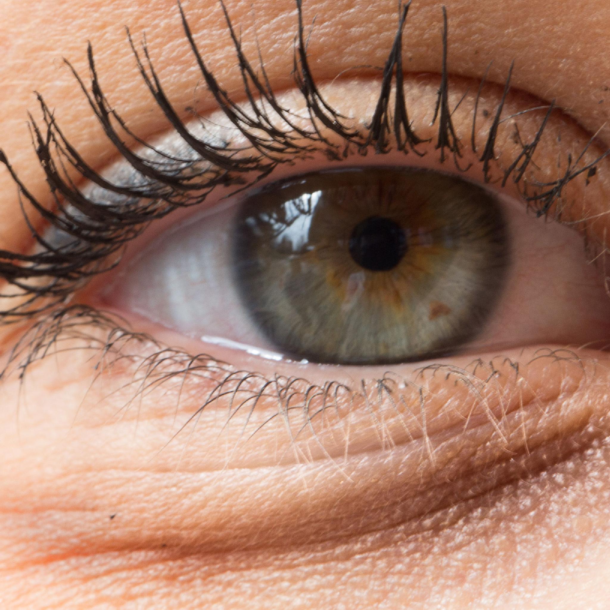 How To Spot The Different Types of Eye Wrinkles?
