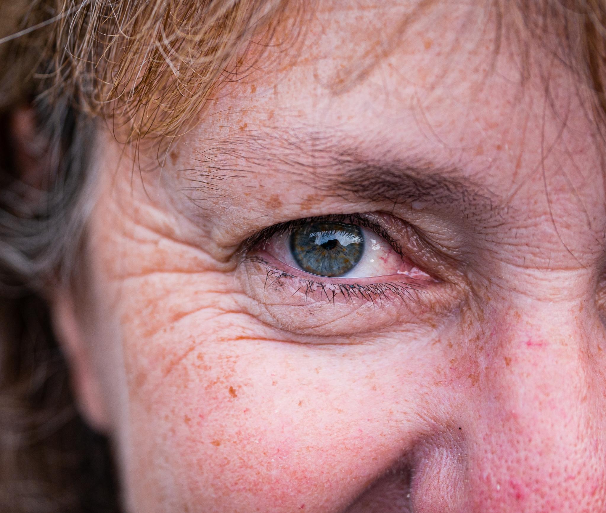 The Real Story Behind Wrinkles