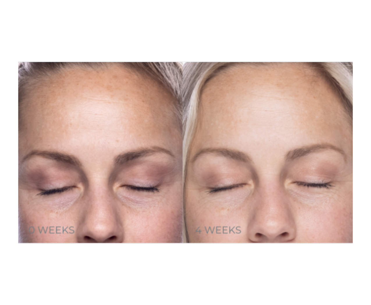 Anti-Aging Peptide Eye Cream | Skincare by Alana