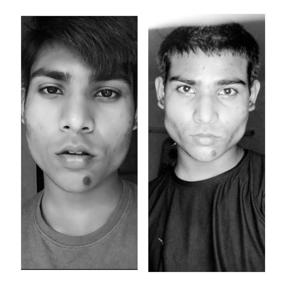 Jawline Exercises: 8 Moves for a Better Jawline