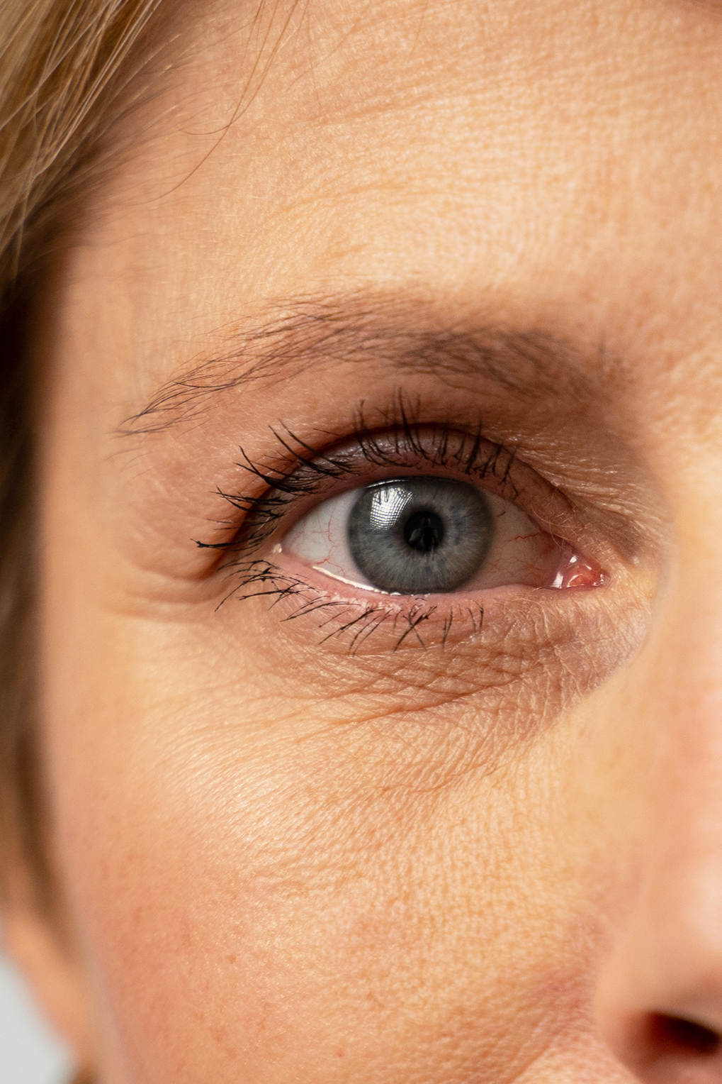 Prevent eyelash shedding with these 5 steps | PrimePrometics