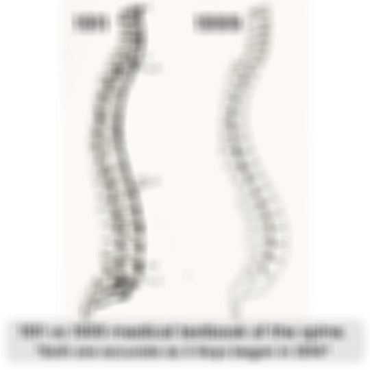 Posture & Biomechanics Correcting Guide – NeuroMD