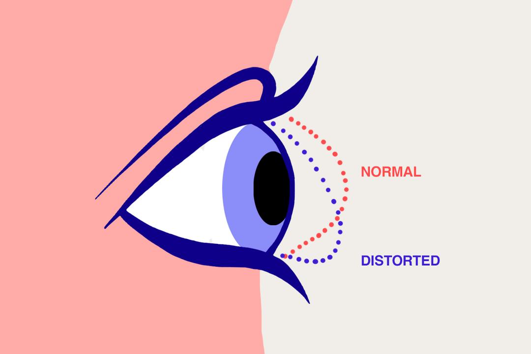 The Hidden Danger of Sleep Masks – Manta Sleep
