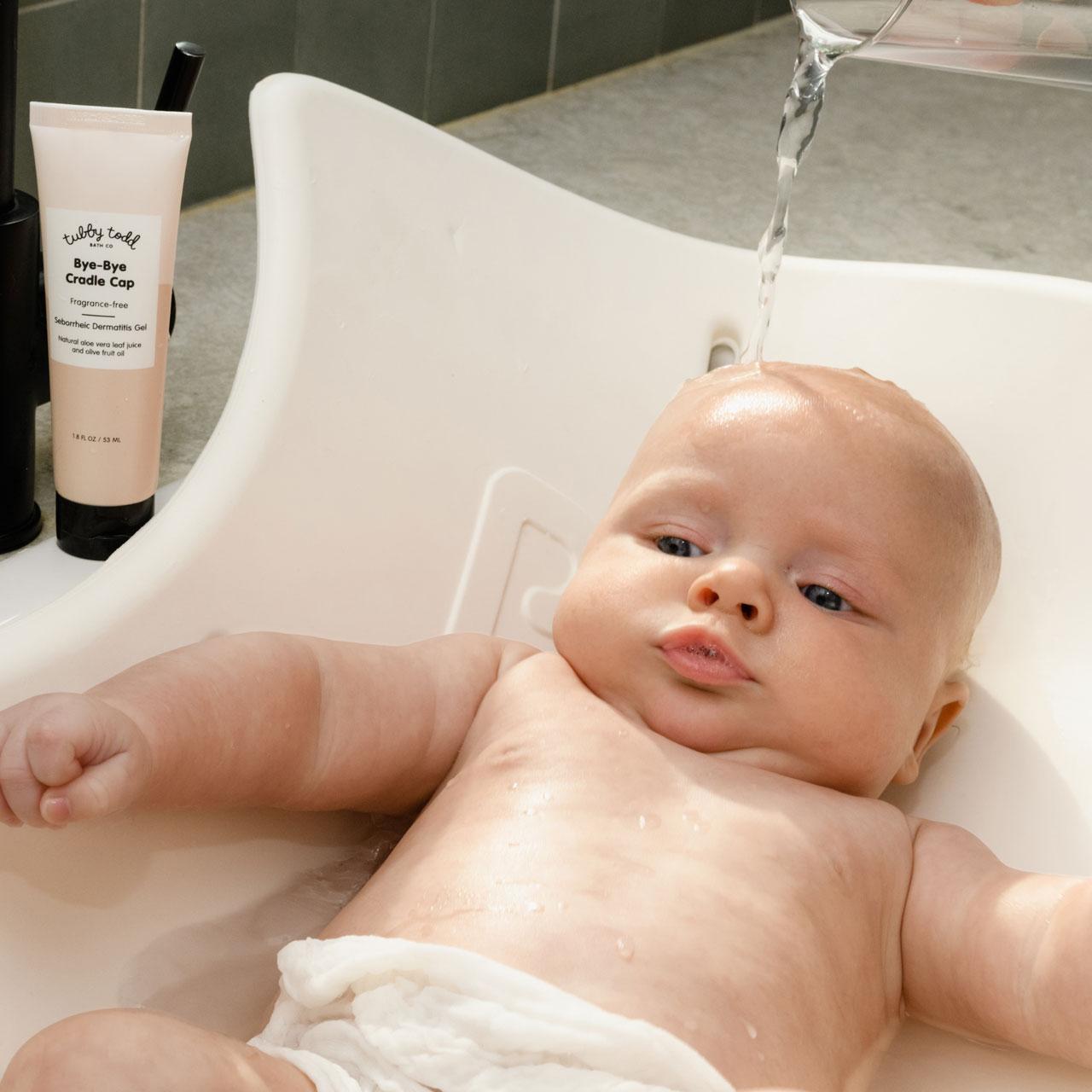 Bye Bye Cradle Cap Landing Page