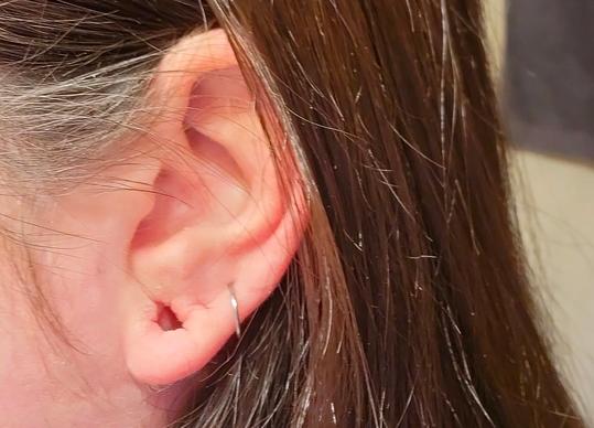 How long does it take for stretched ears to close? – Two Feather Plugs