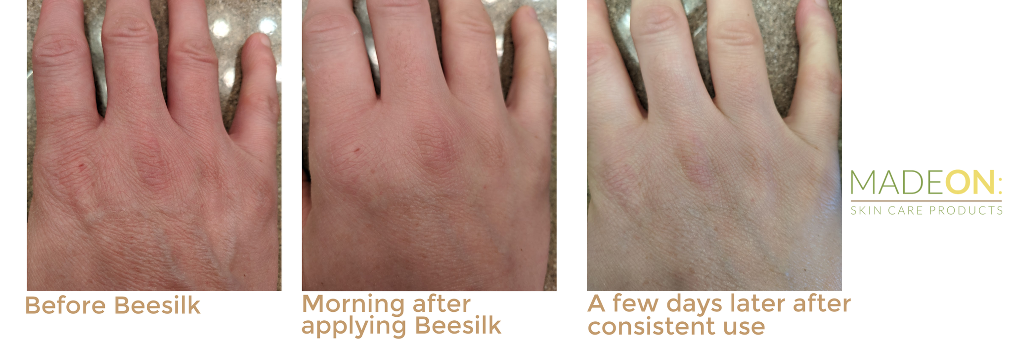 Can you fix your skin for $17? Yes, you can!