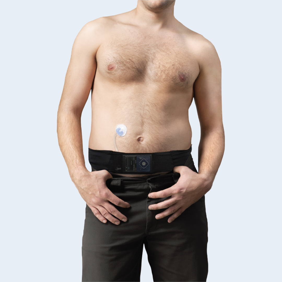 Insulin Pump Accessories | Glucology Diabetes