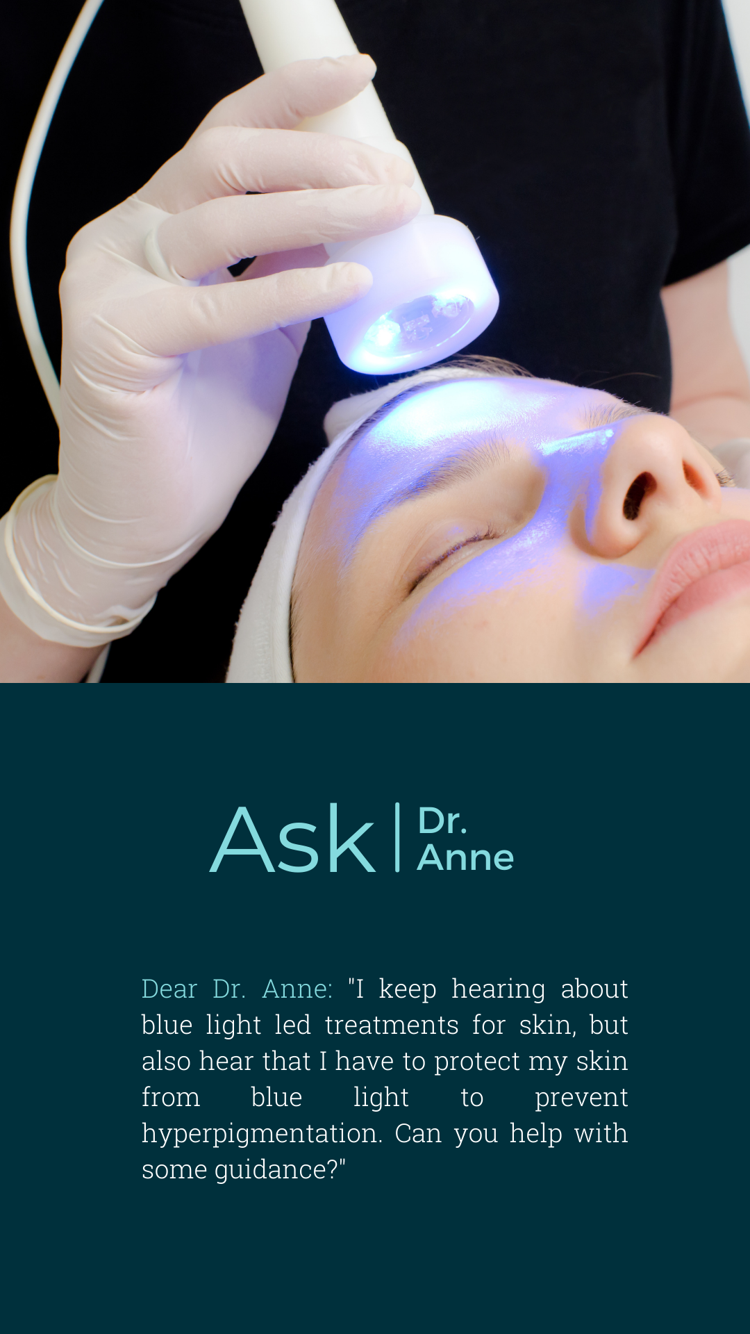 Blue Light and Hyperpigmentation