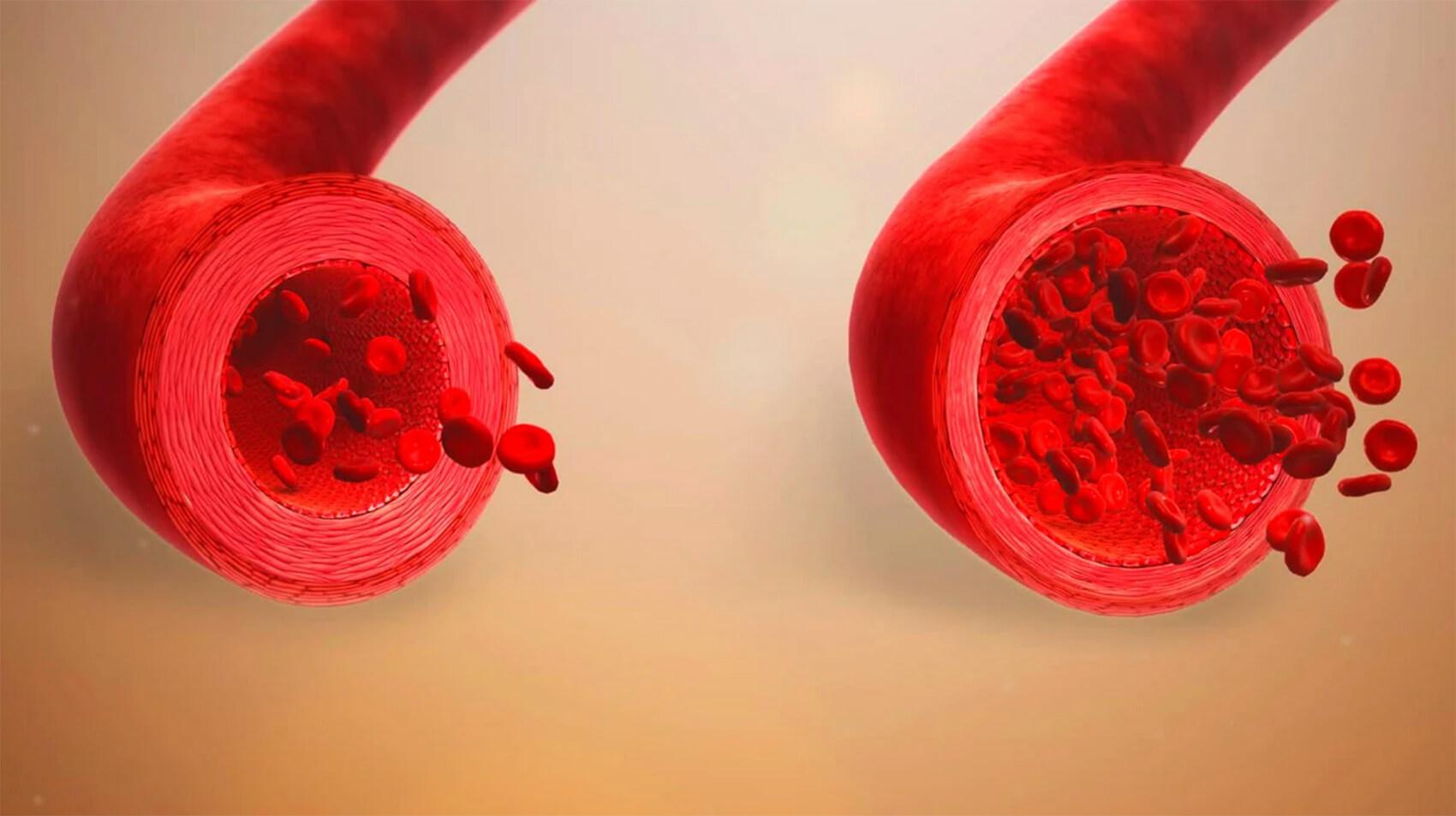 5 Reasons To Use Red Light Therapy When You Are Fasting – Mychondria