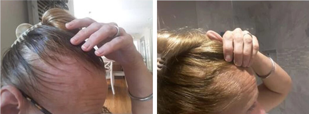 More Hair Naturally 9