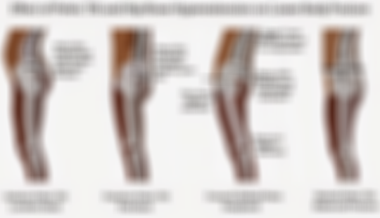 Posture & Biomechanics Correcting Guide – NeuroMD