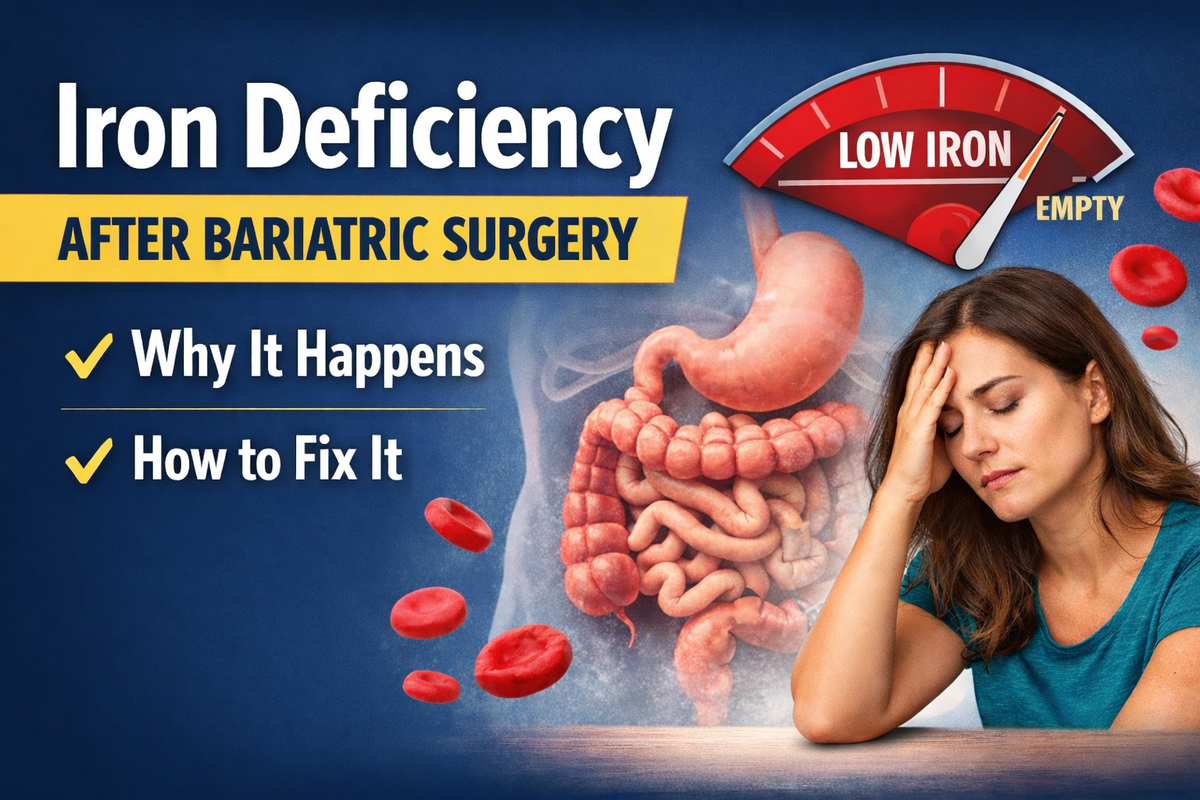 Iron Deficiency After Bariatric Surgery: Why It Happens, Why It’s Miss