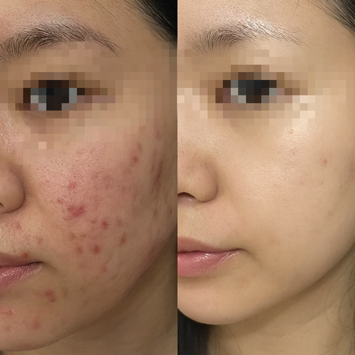 free-3-week-skin-repair-protocol