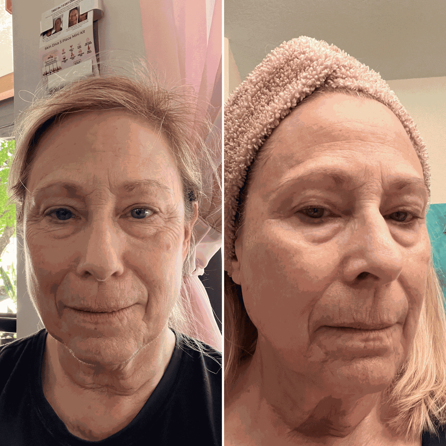Regenerative Vegan Skincare | Non-Toxic NAD+ Solutions |Skin Diva Labs