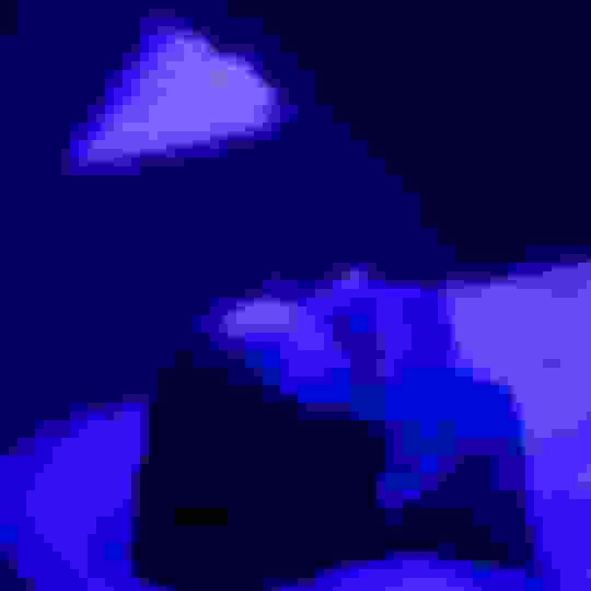 Blue Light and Hyperpigmentation