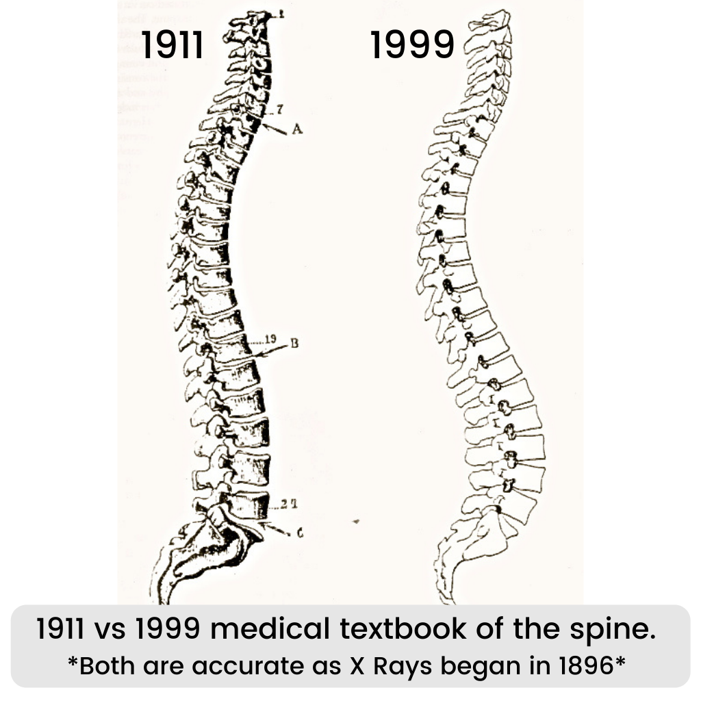 Posture & Biomechanics Correcting Guide – NeuroMD