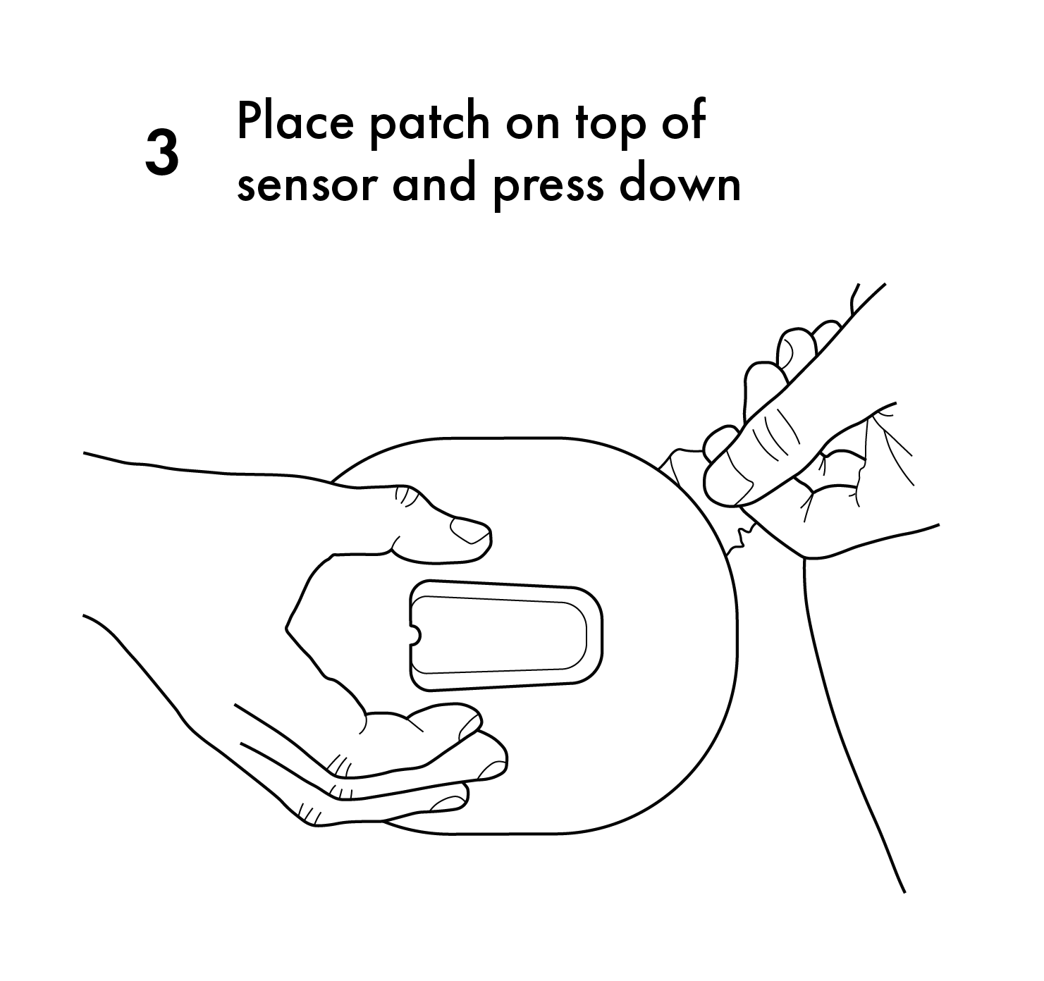 Buy Glucology CGM Patches Online | IBD Medical