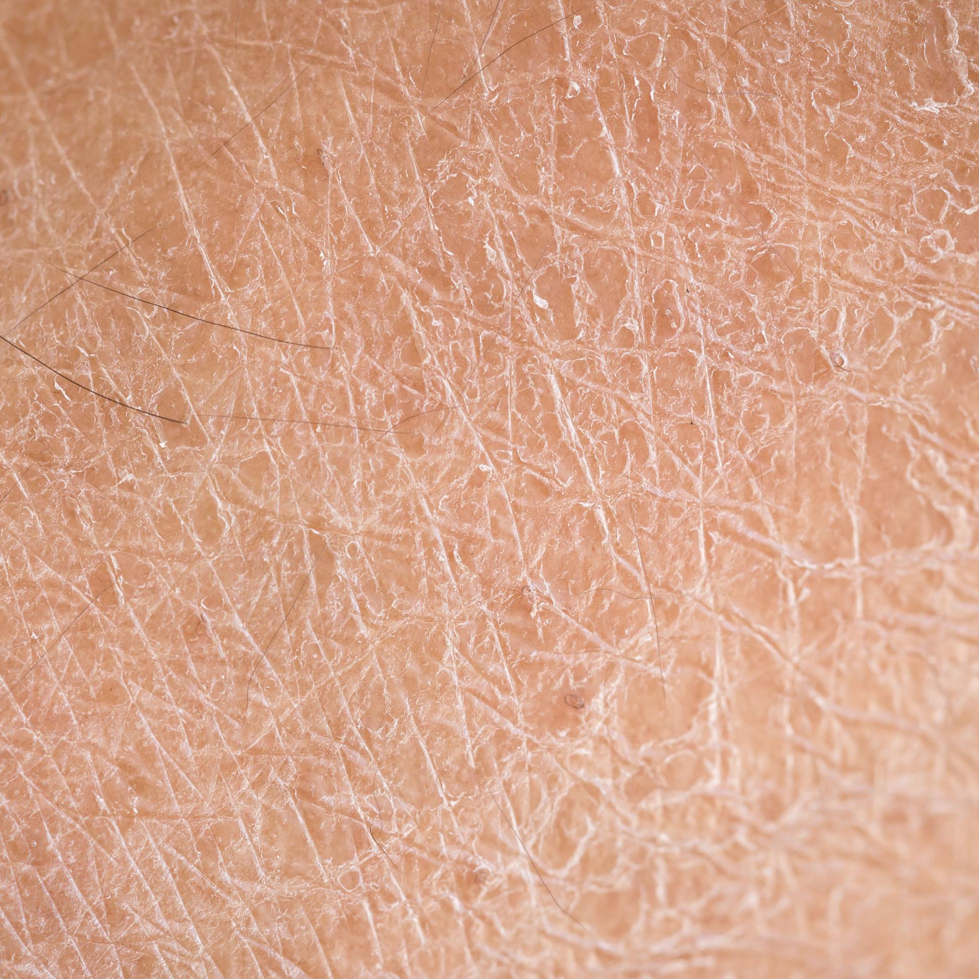 Top 5 Early Signs of Aging