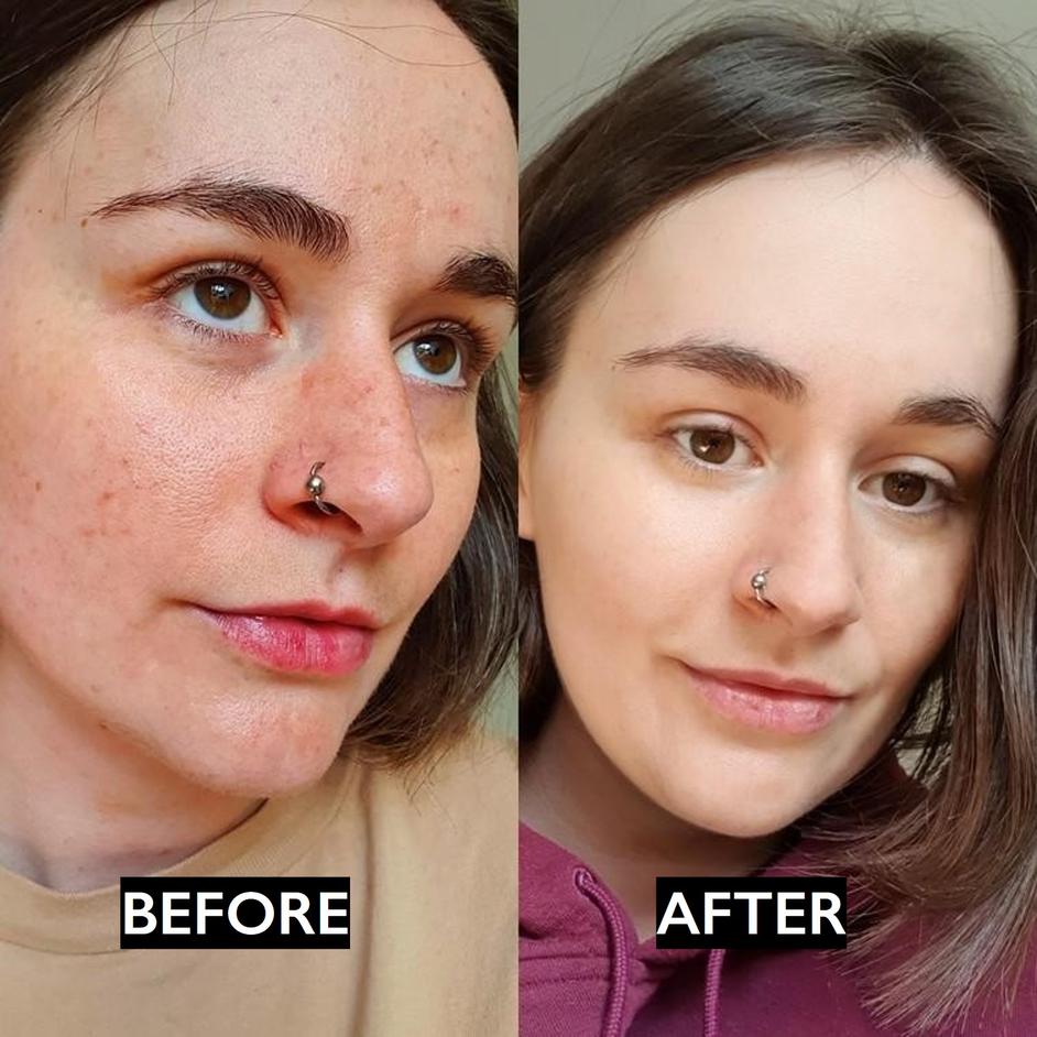 UpCircle Beauty | Introduction To Sustainable Zero Waste Skincare
