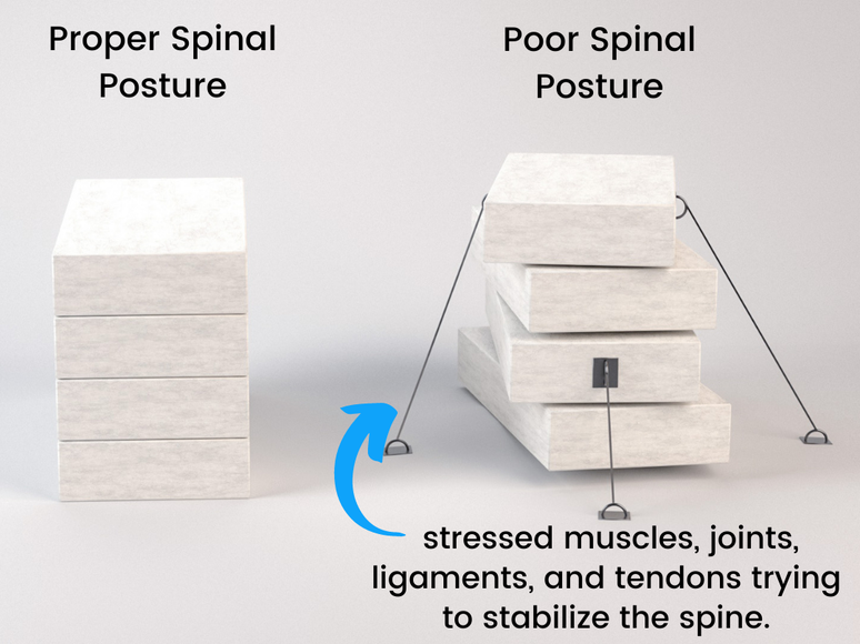 Posture & Biomechanics Correcting Guide – NeuroMD
