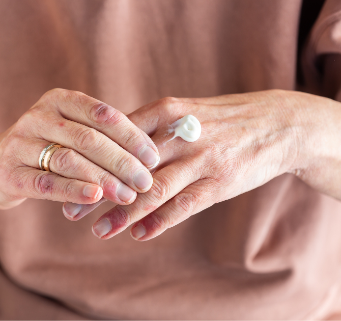The Connection Between Stress and Skin Health