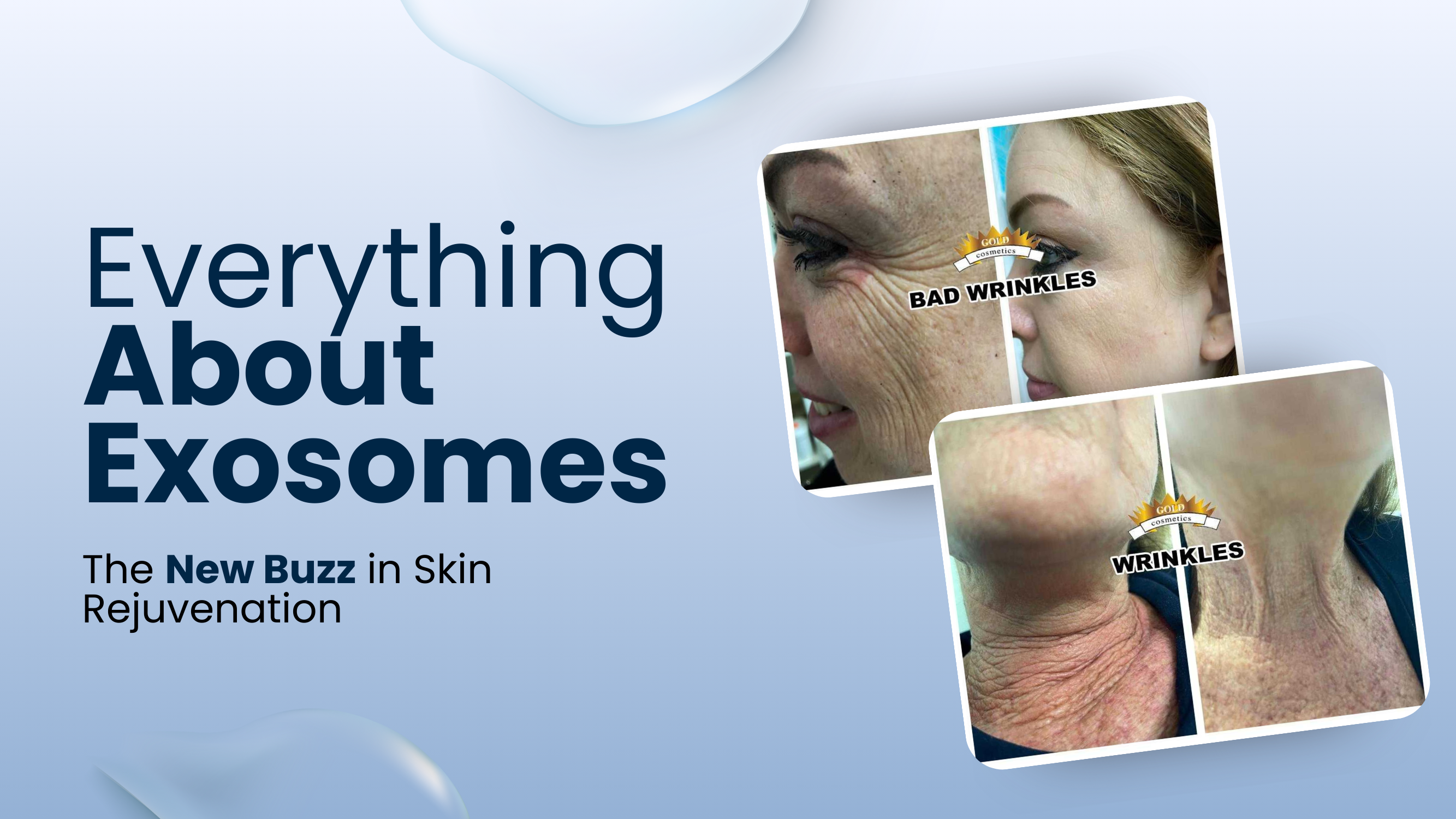 Exosomes Therapy: The Future of Anti-aging Skincare
