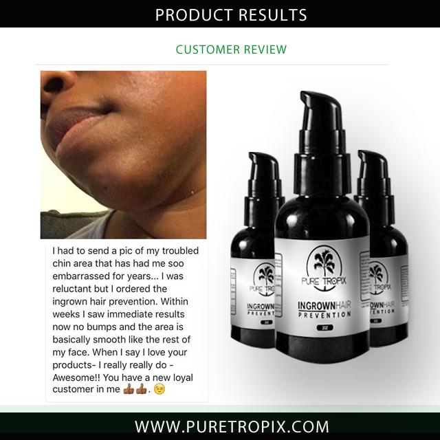 Ingrown Hair Product Page – Pure Tropix