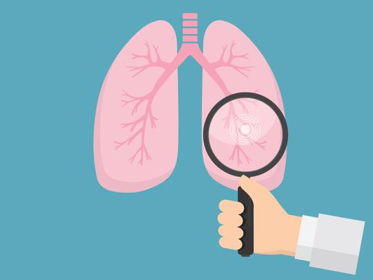 Bronhitis - Simptomi, Uzroci i Kako ga Ublažiti