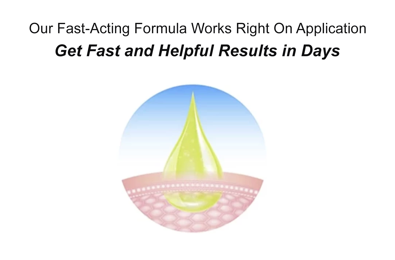 SORARESAL® Psoriasis Cream