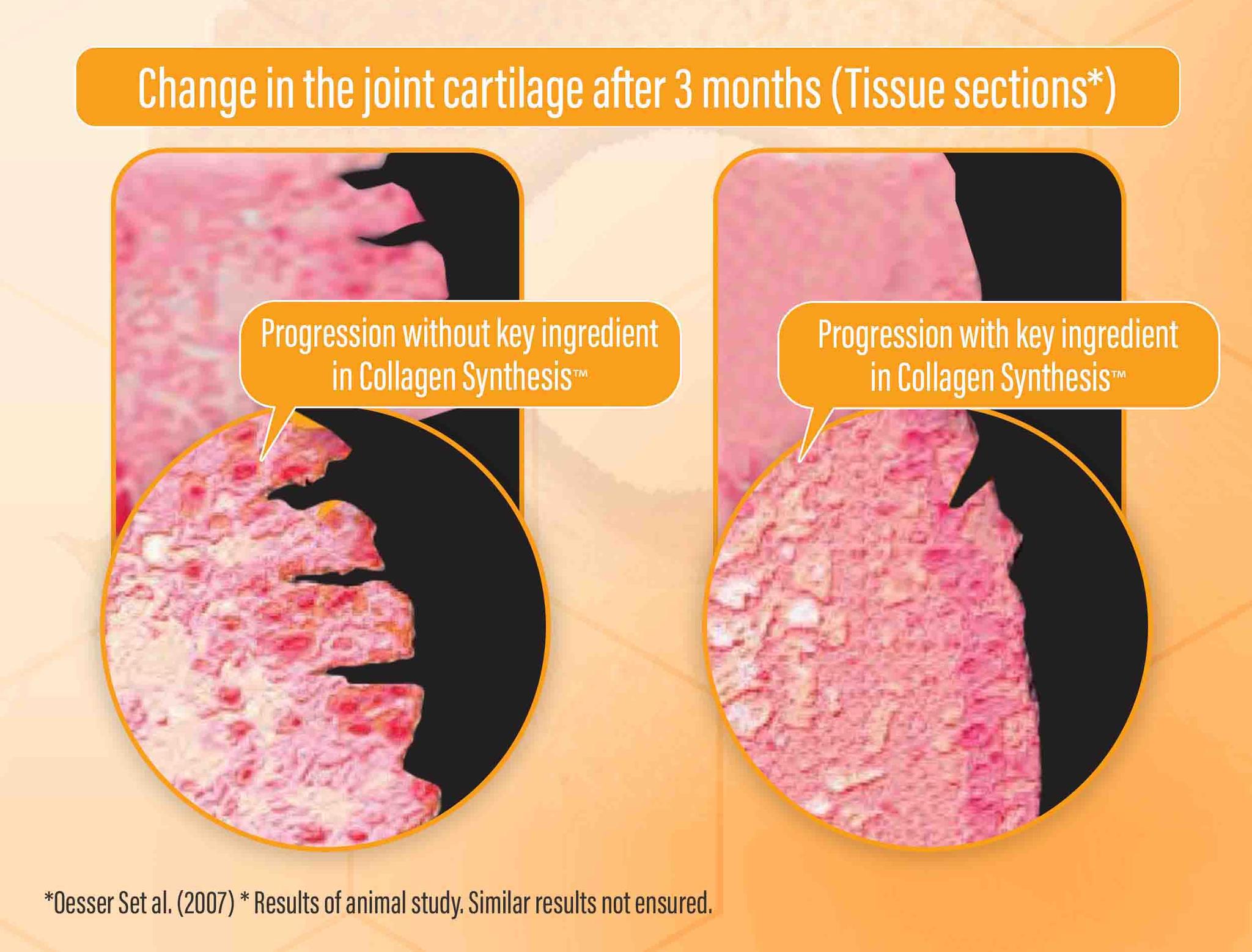 Collagen After Surgery: When To Take It, When To Avoid It, and How It