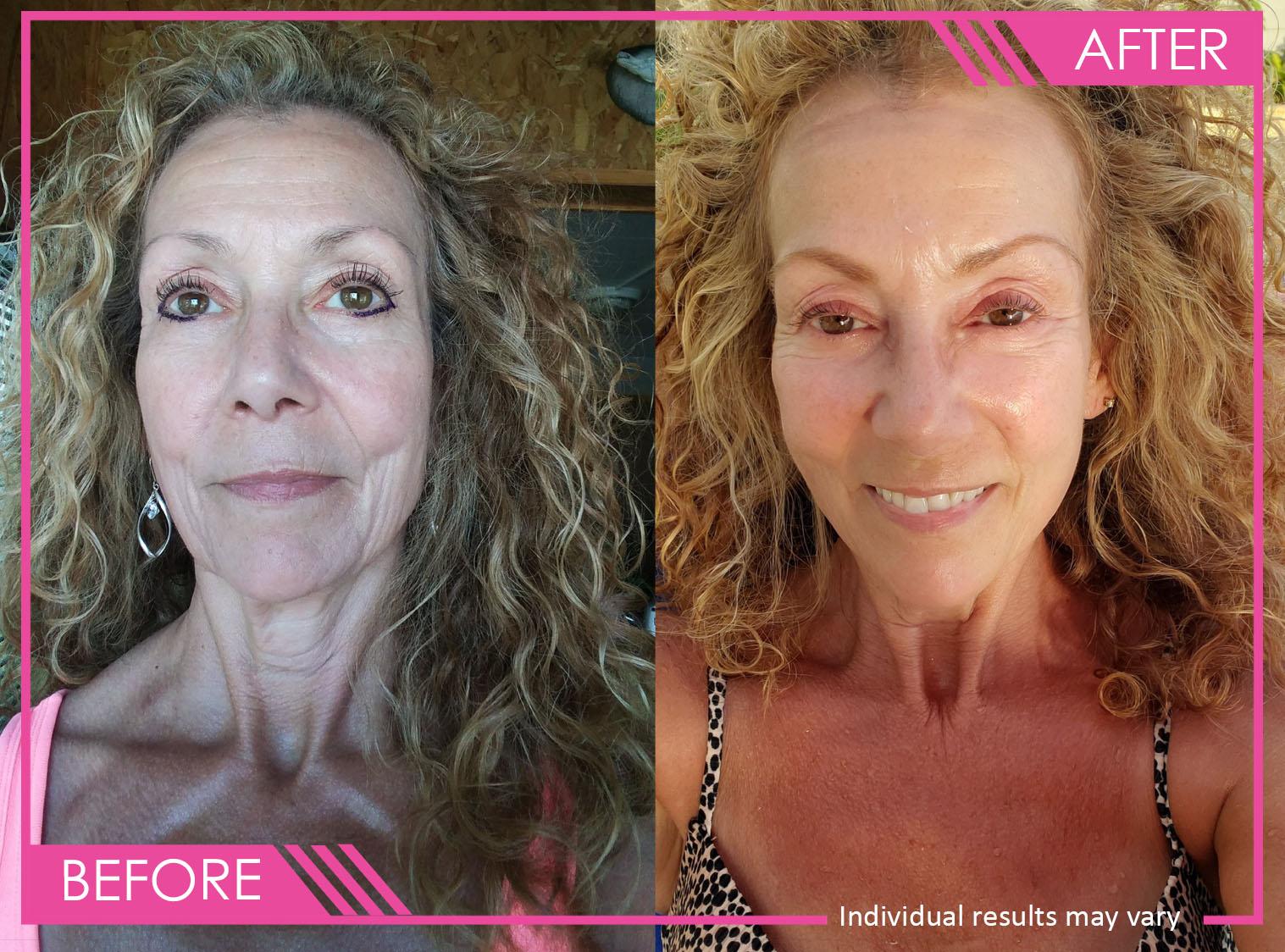 Super C Serum | Vibriance