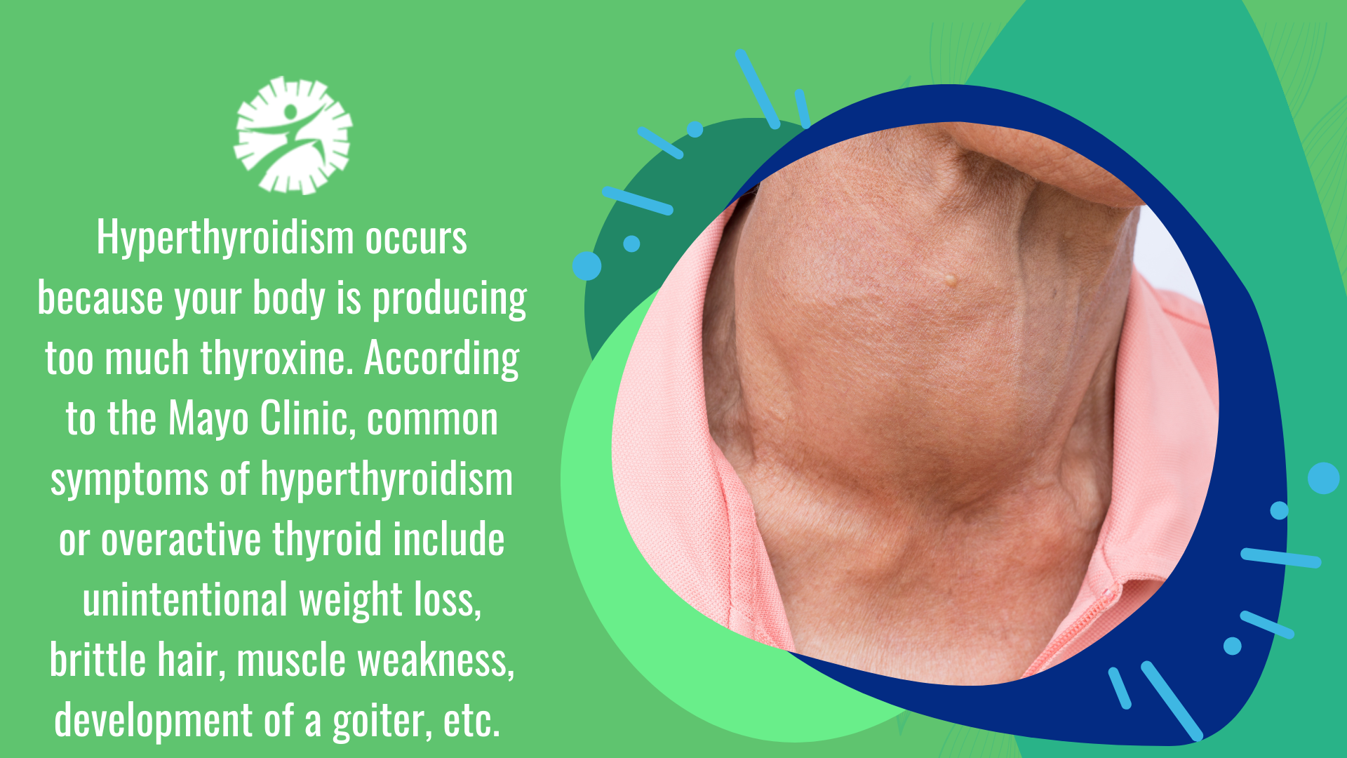 Signs and Symptoms of Thyroid Problems - 1 Body