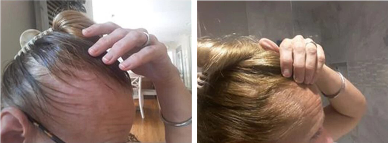 More Hair Naturally 9 plus Hair and Scalp Synergy