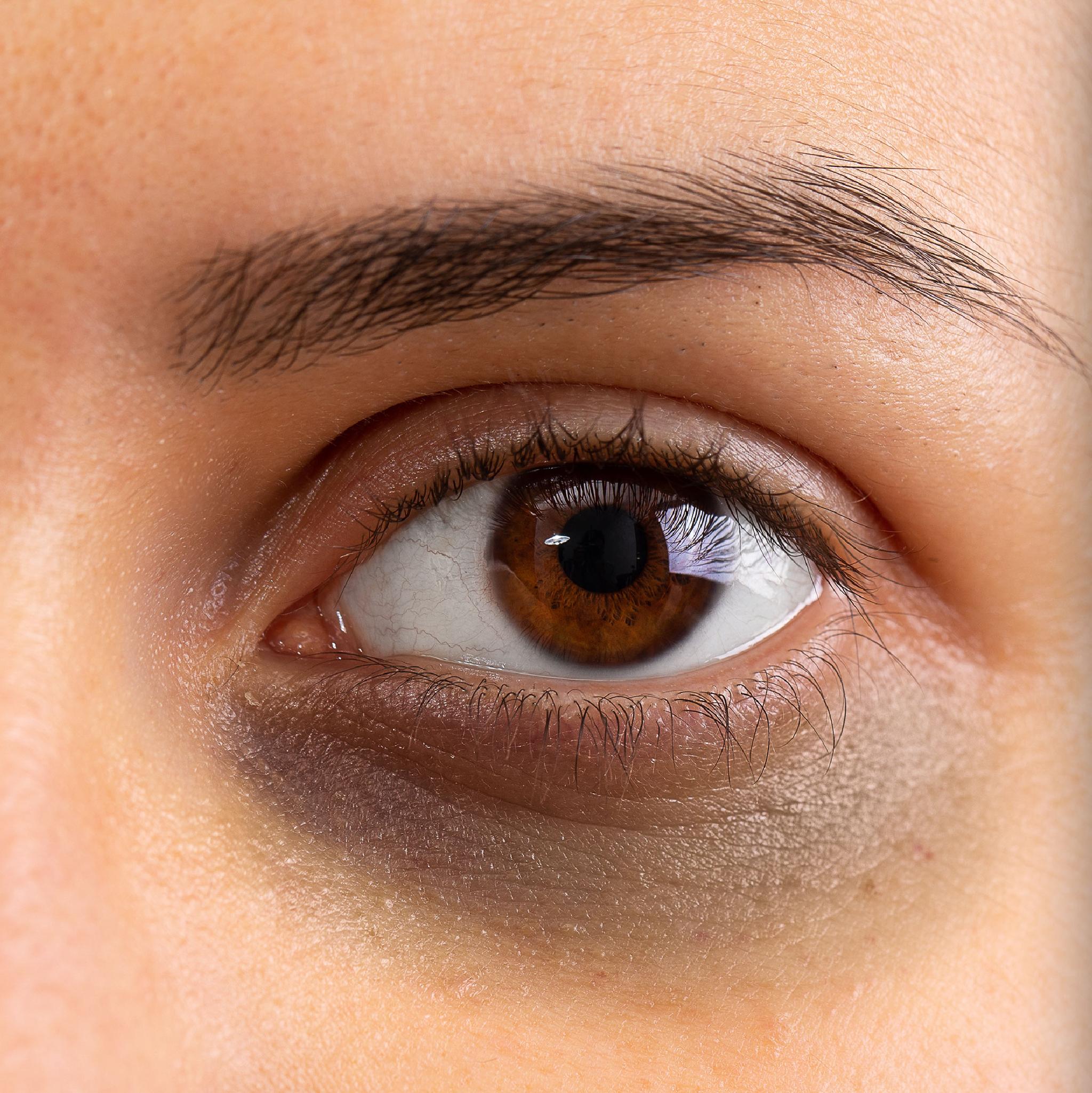 Top 5 Early Signs of Aging