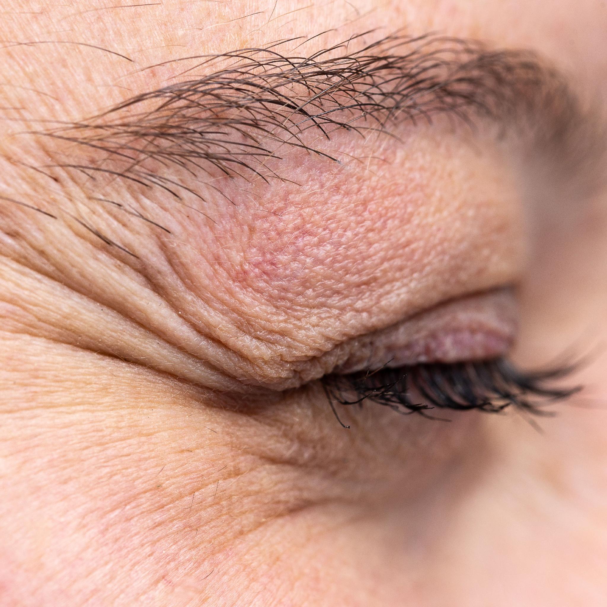 Top 5 Early Signs of Aging