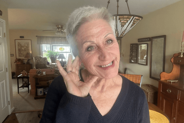 How to Manage Acne in your 50's, 60's, 70's, and Beyond | Vibriance