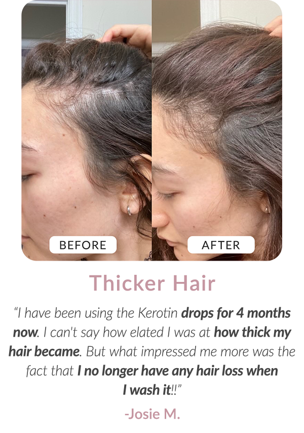 Kerotin Hair Growth Drops