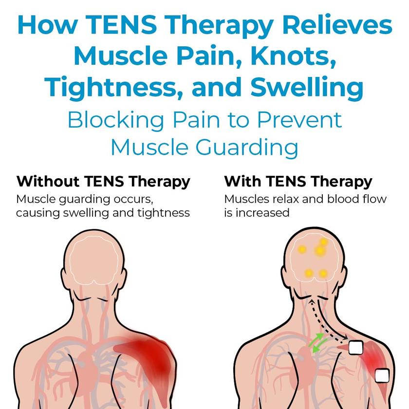 Using TENS Therapy for Muscle Pain Relief – TENS 7000
