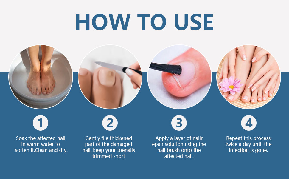 Natural Toenail Solution: Repair Damaged Nails with Organic Herbs