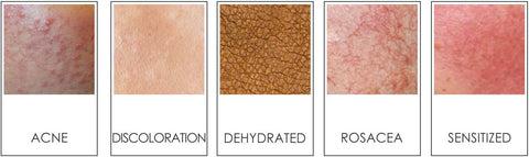 What is your Skin Type? Take Our Skin-Type Test – Moon Haven