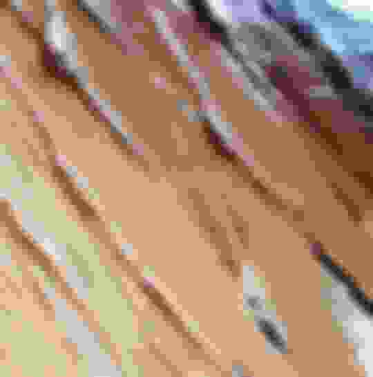 Blue Light and Hyperpigmentation