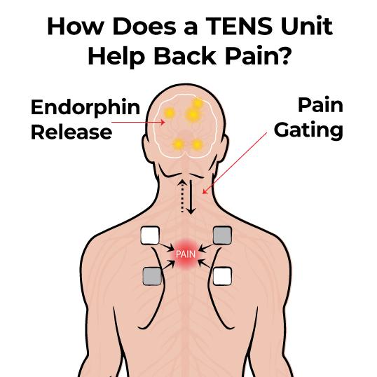 TENS Therapy for Back Pain Relief – TENS 7000