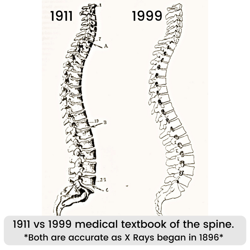 Posture & Biomechanics Correcting Guide – NeuroMD