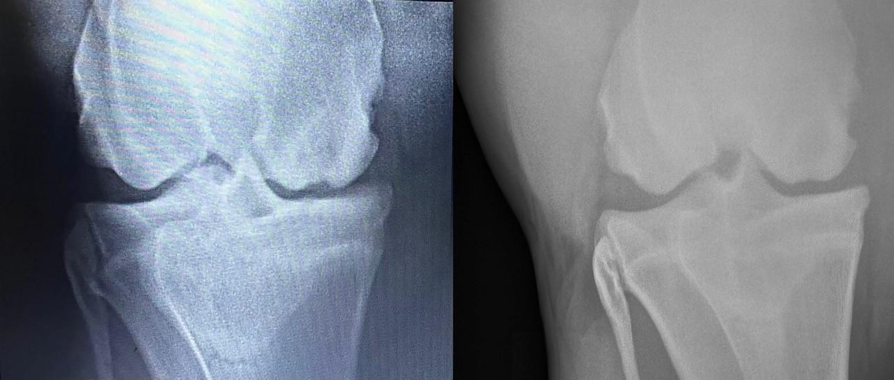 Osteo-MAX | Equine Bone & Joint Support | 100X Equine