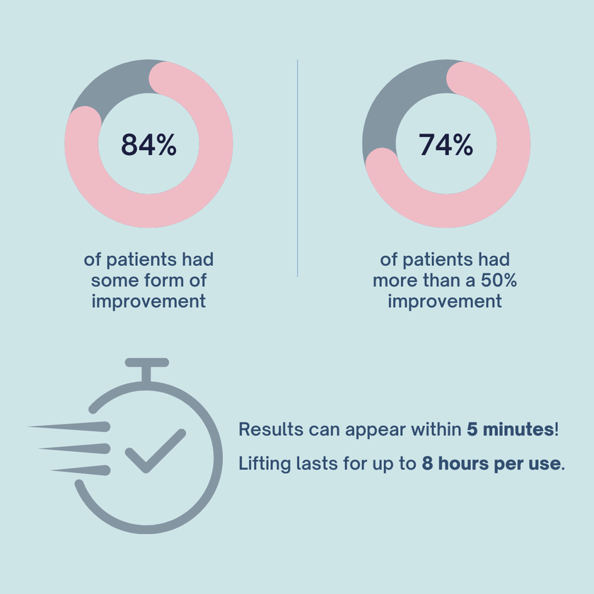 Upneeq Eye Drops - 30 Vials (Buy Online) | Skincare by Alana