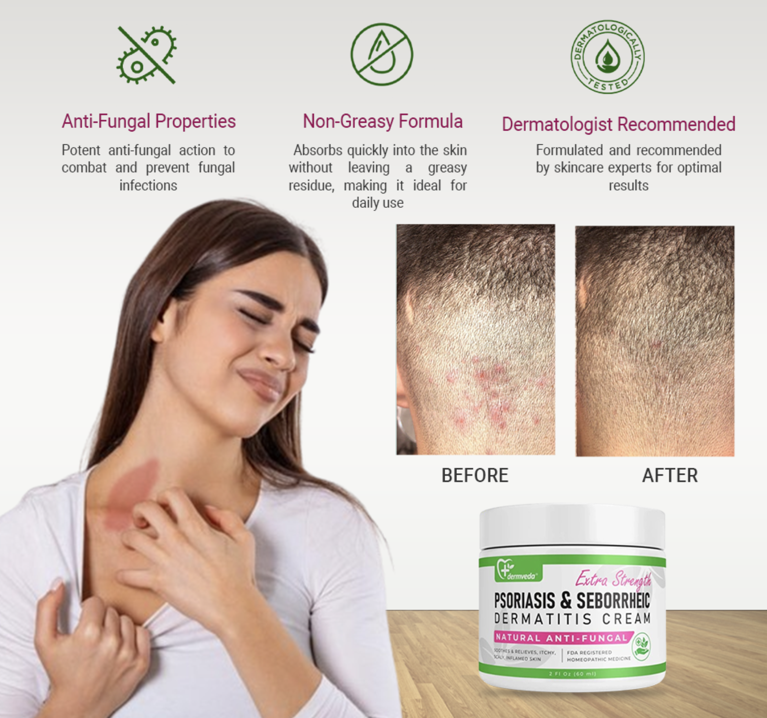 Psoriasis & Seborrheic Dermatitis Treatment Relief Cream