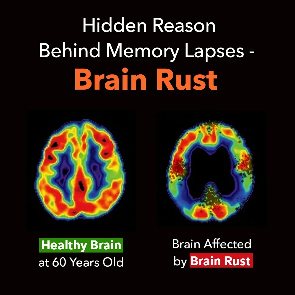 Breakthrough Research Reveals… The Hidden Root Cause of Memory Lapses,